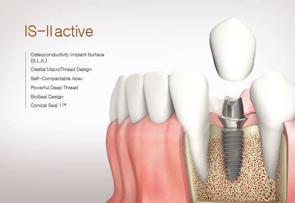 IS-II Active Fixture